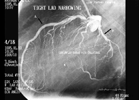 Department of Anatomy and Cellular Biology Medical Gross Anatomy Home Page