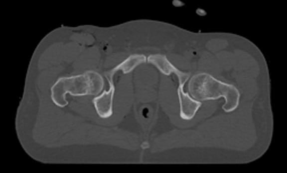 Department of Anatomy and Cellular Biology Cross Sectional Anatomy Home ...