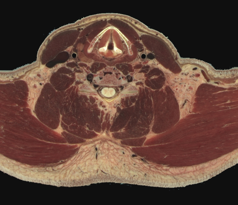 Department of Anatomy and Cellular Biology Cross Sectional Anatomy Home ...