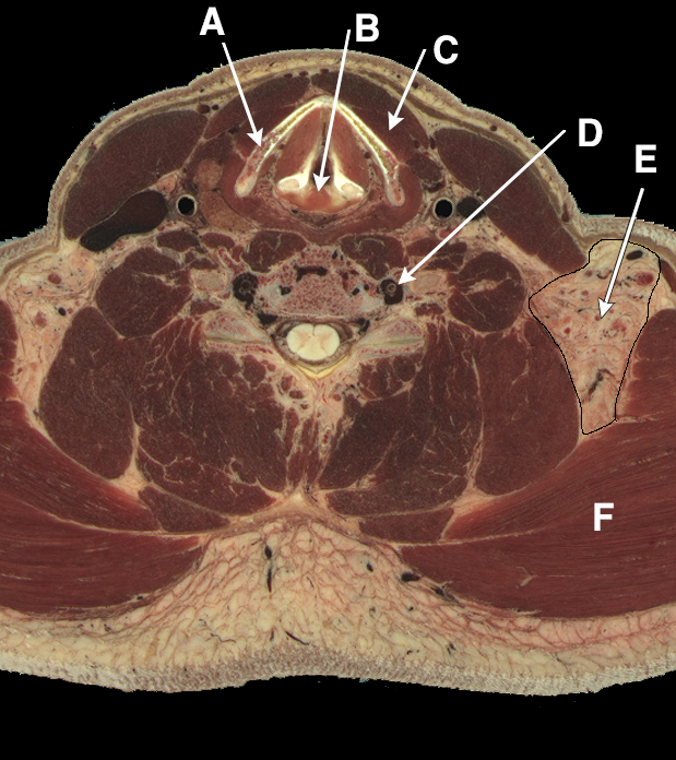 Department of Anatomy and Cellular Biology Cross Sectional Anatomy Home ...
