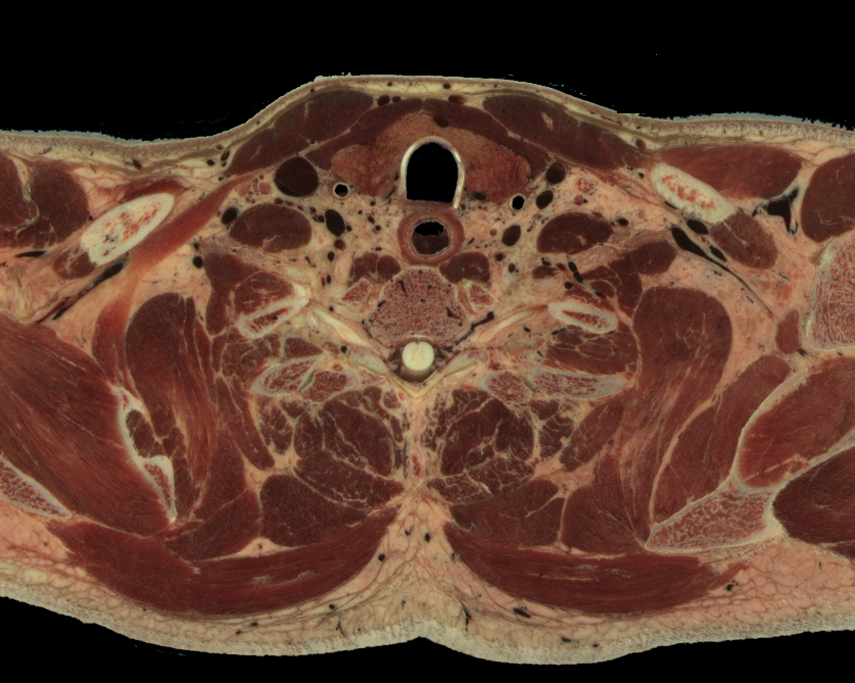Department of Anatomy and Cellular Biology Cross Sectional Anatomy Home ...