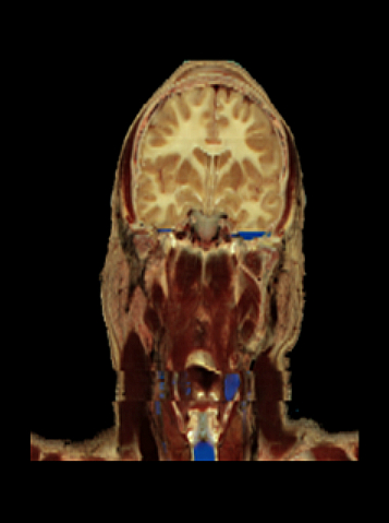 Department of Anatomy and Cellular Biology Dental Gross Anatomy Home Page