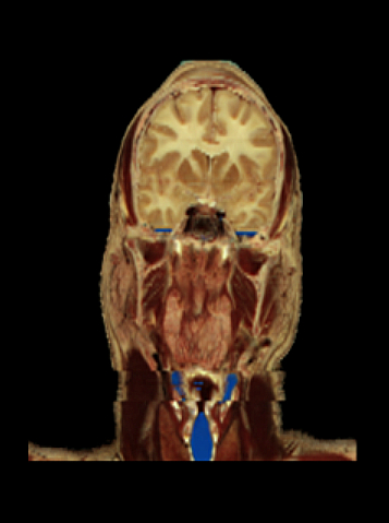 Department of Anatomy and Cellular Biology Dental Gross Anatomy Home Page