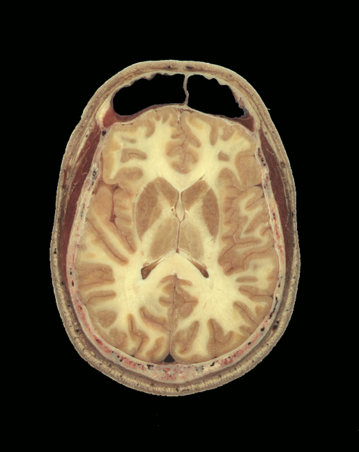 Department of Anatomy and Cellular Biology Cross Sectional Anatomy Home ...