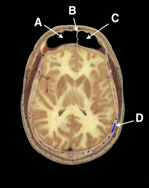 Department of Anatomy and Cellular Biology Cross Sectional Anatomy Home ...