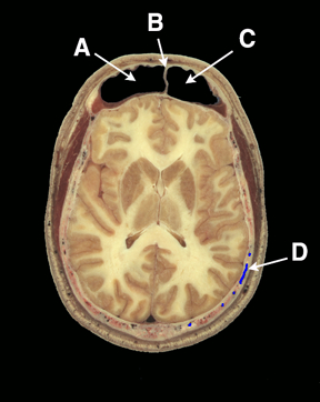 Department of Anatomy and Cellular Biology Cross Sectional Anatomy Home ...
