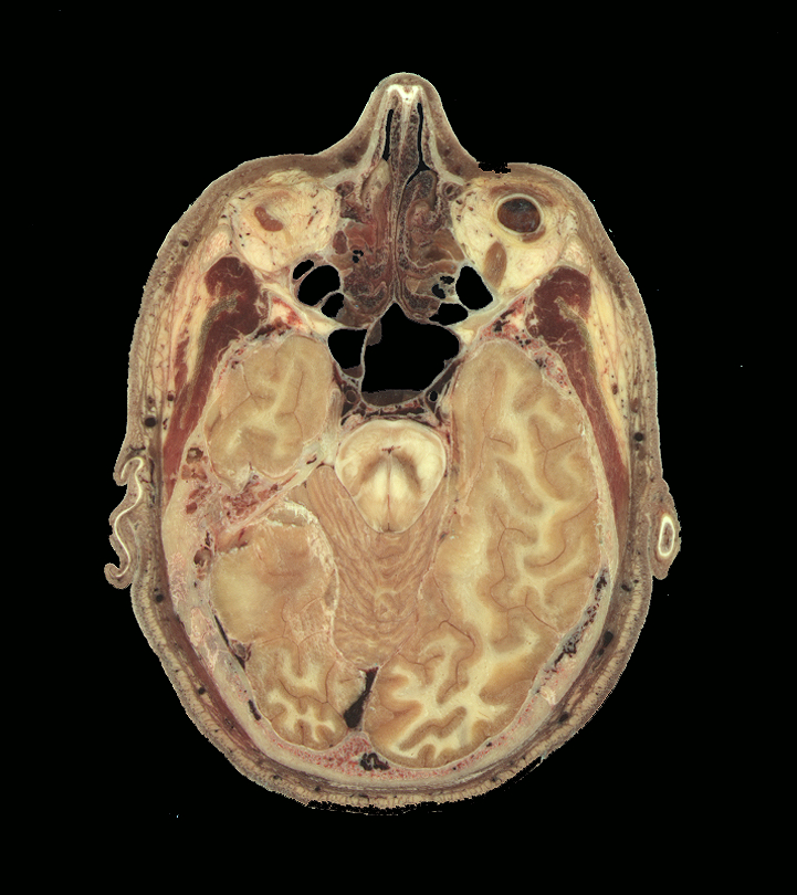 Department of Anatomy and Cellular Biology Cross Sectional Anatomy Home ...
