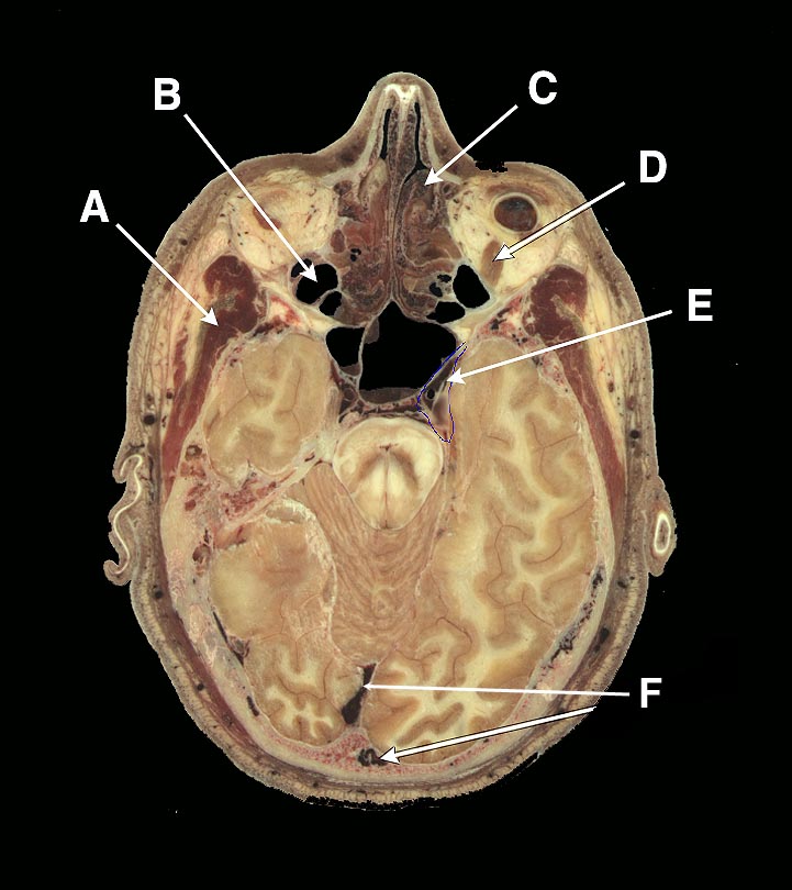 Department of Anatomy and Cellular Biology Cross Sectional Anatomy Home ...
