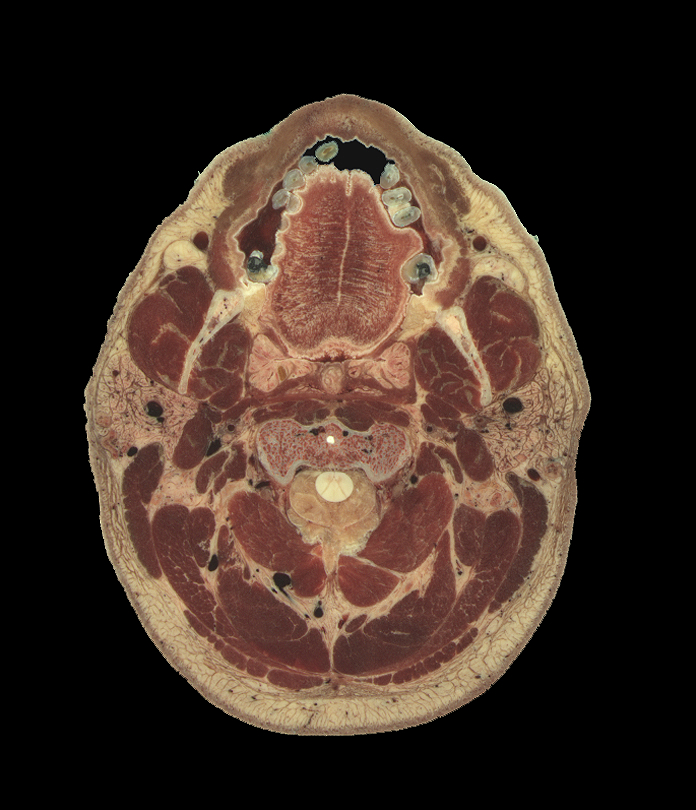Department of Anatomy and Cellular Biology Cross Sectional Anatomy Home ...