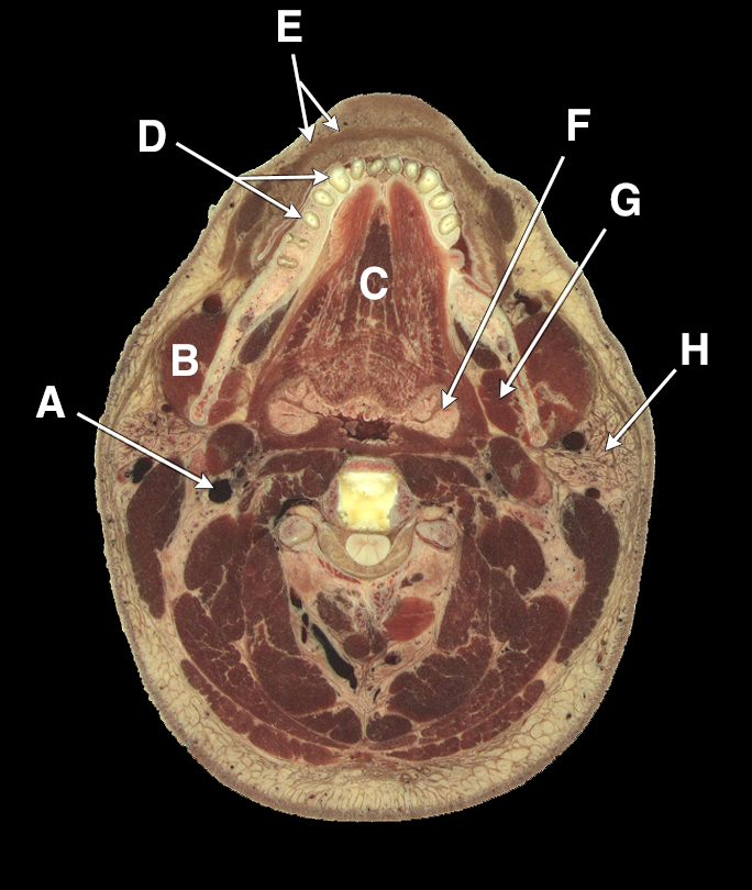 Department of Anatomy and Cellular Biology Cross Sectional Anatomy Home ...