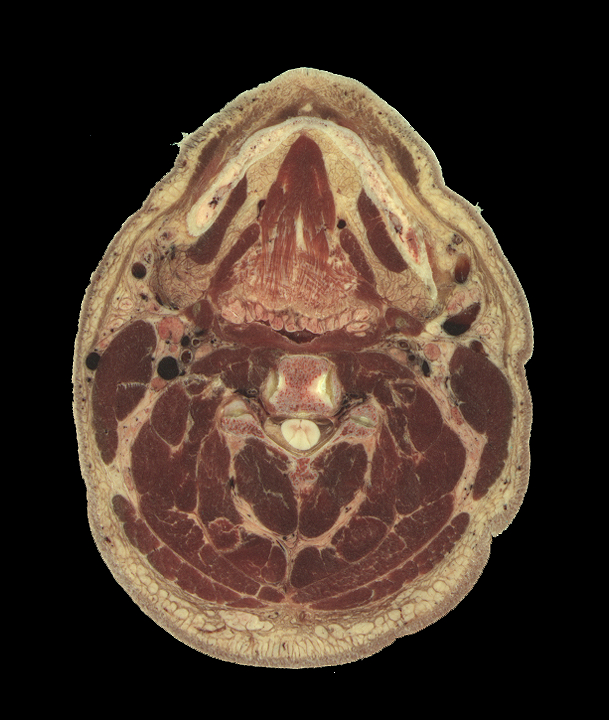 Department of Anatomy and Cellular Biology Cross Sectional Anatomy Home ...