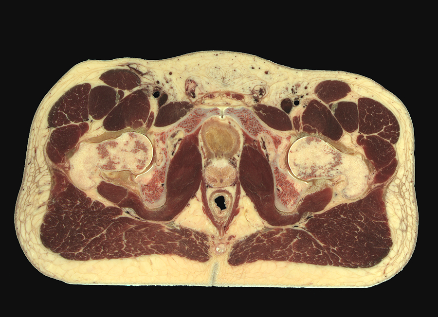Department of Anatomy and Cellular Biology Cross Sectional Anatomy Home ...