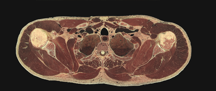 Department of Anatomy and Cellular Biology Cross Sectional Anatomy Home ...