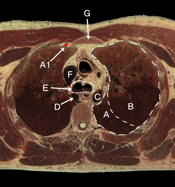 Department of Anatomy and Cellular Biology Cross Sectional Anatomy Home ...